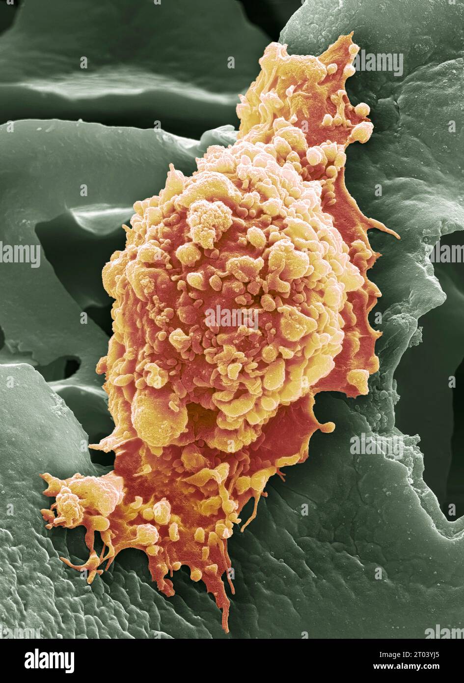 HeLa cell. Coloured scanning electron micrograph (SEM) of a HeLa cell ...