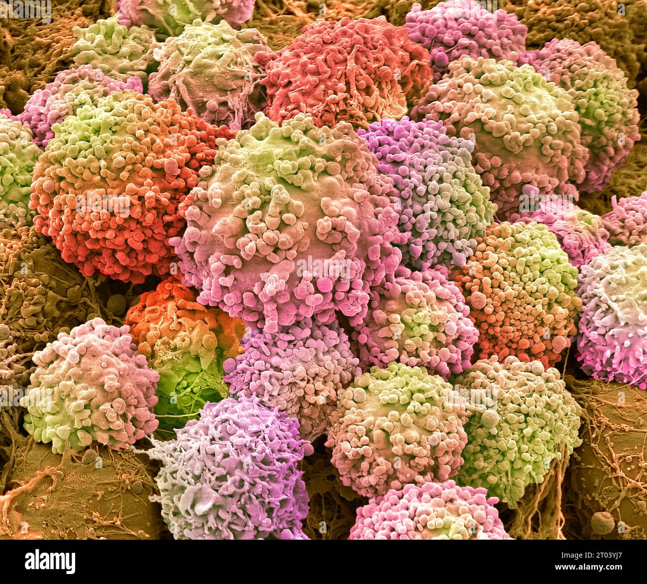 Coloured scanning electron micrograph (SEM) of a neural organoid ...