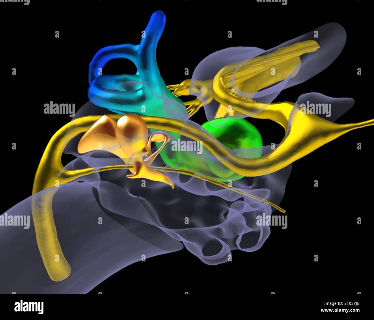 Coloured 3D composite computed tomography (CT) and magnetic resonance ...