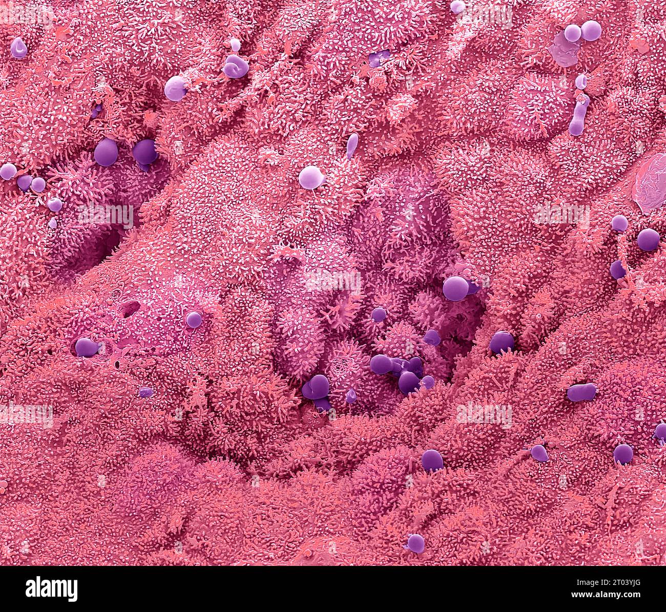 Uterus endometrium. Coloured Scanning Electron Micrograph (SEM ...