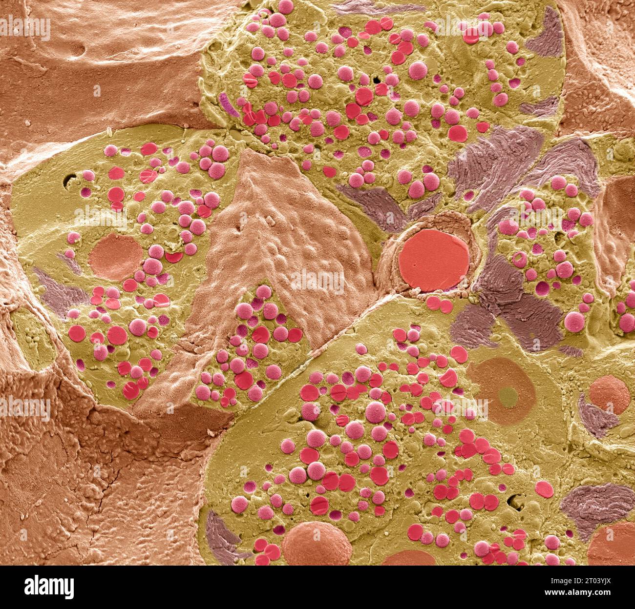 Pancreatic tissue. Scanning electron micrograph (SEM) of a freeze ...