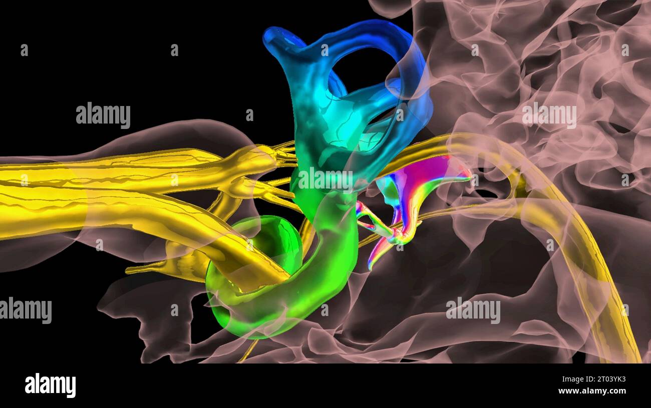 Coloured 3D composite computed tomography (CT) and magnetic resonance ...