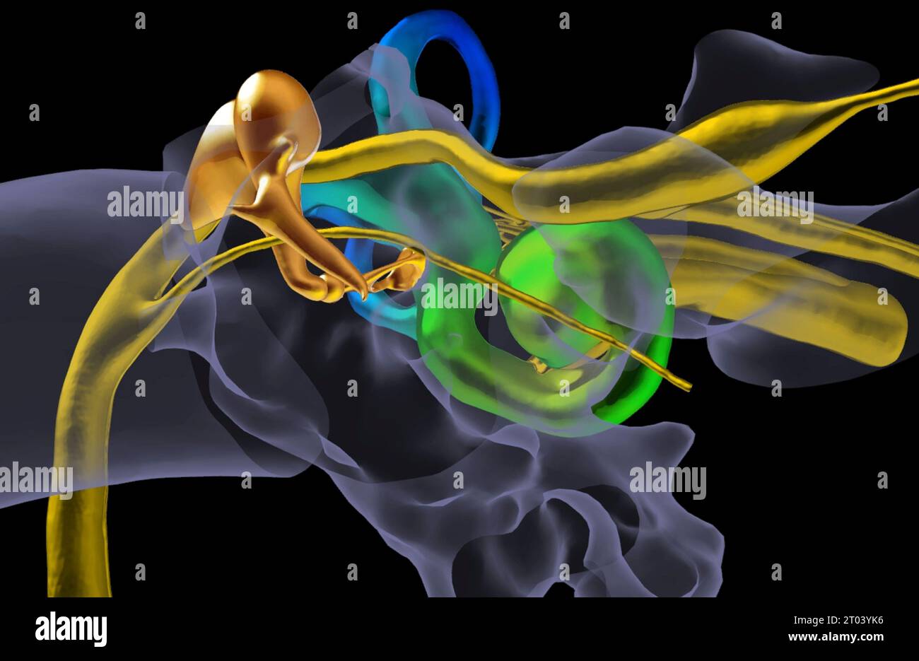 Coloured 3D composite computed tomography (CT) and magnetic resonance ...