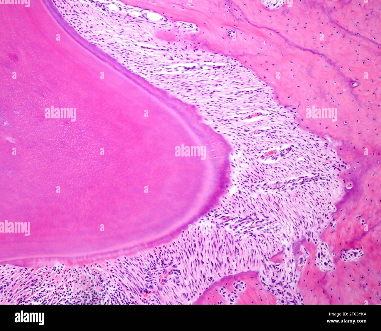 Light micrograph of a cross-sectioned tooth root showing from the left ...