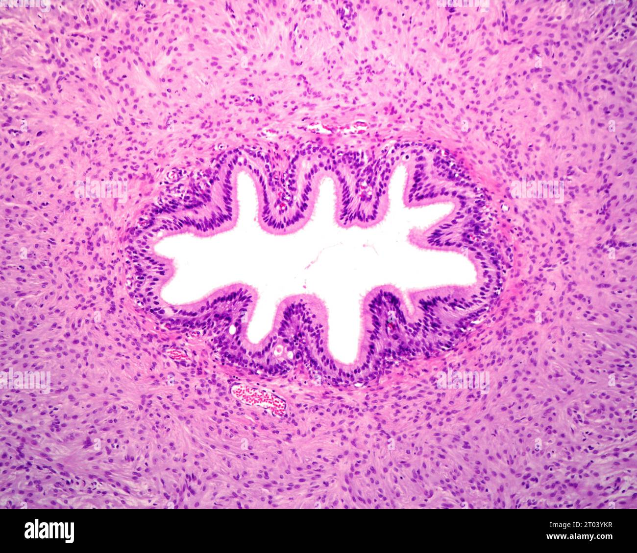 Light micrograph showing a cross-sectioned vas deferens. The star ...