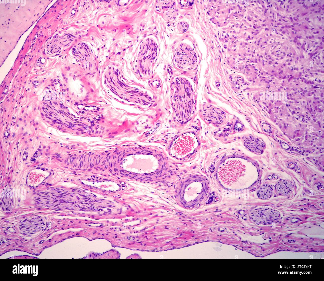 Light micrograph of connective tissue showing four small veins with ...