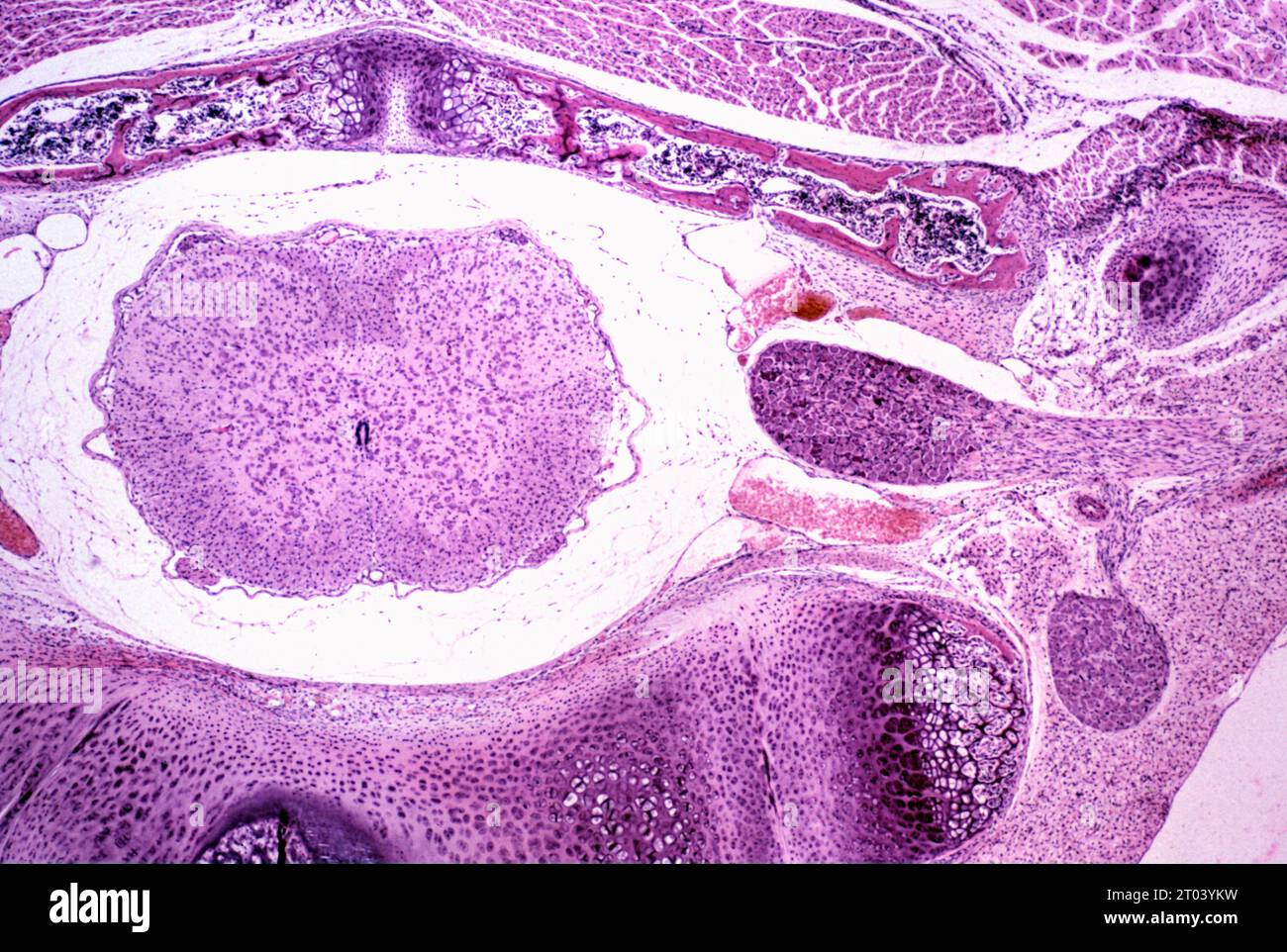 Spinal Sensory Ganglion, Light Micrograph – MHIM