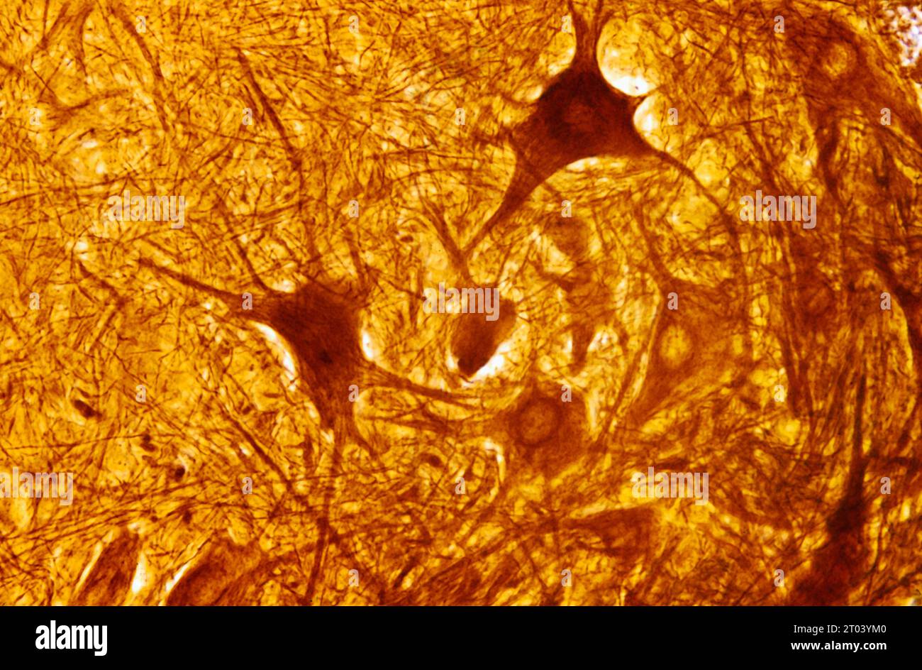 Silver Nitrate Stain