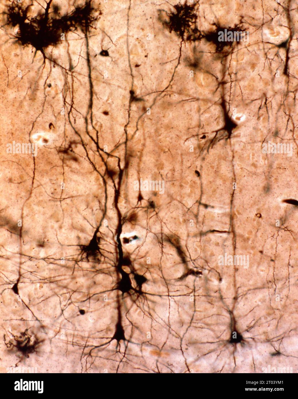 Light micrograph of pyramidal neurons of the cerebral cortex stained ...