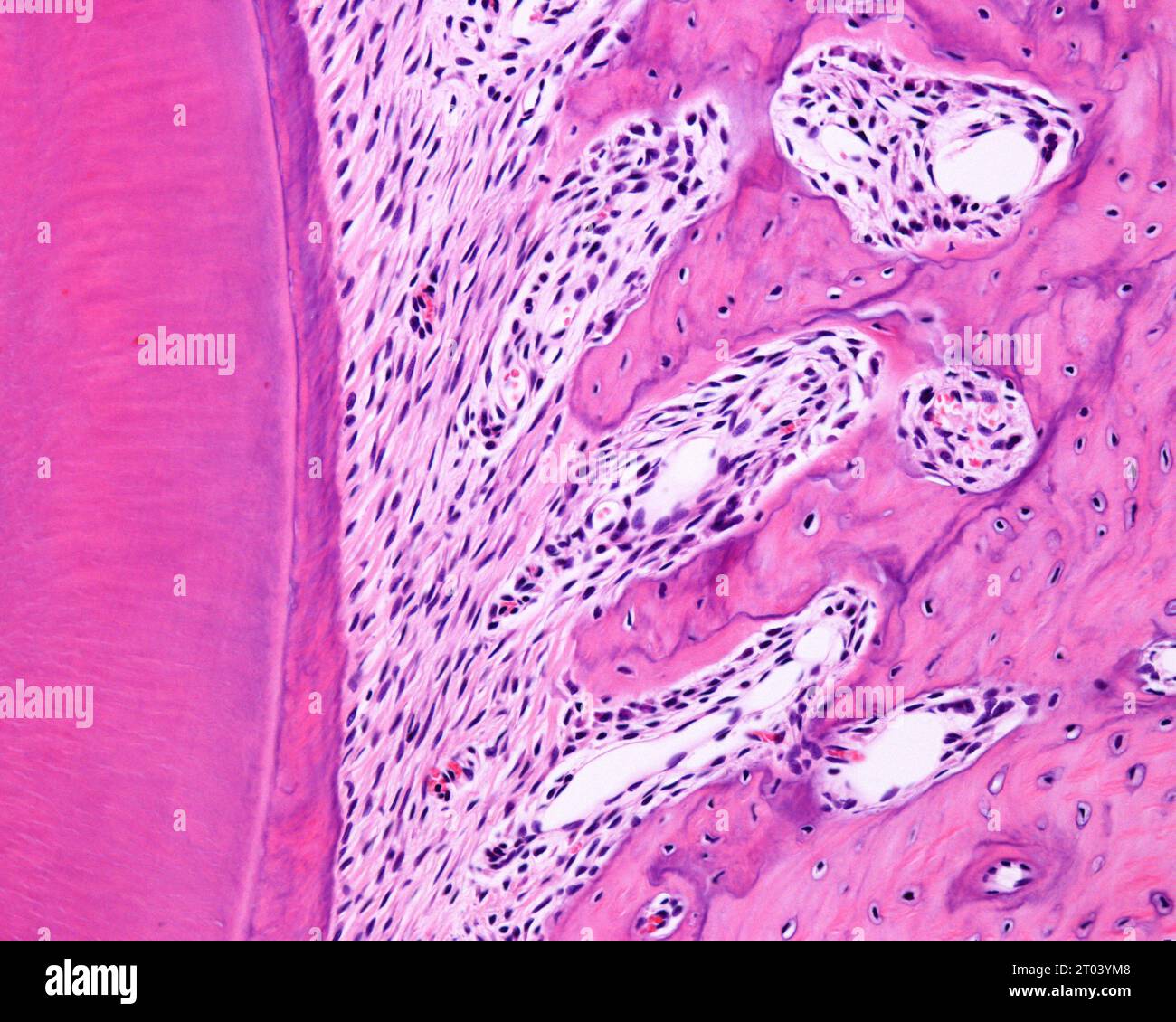 Light micrograph of a tooth root showing, from left to right, dentine ...