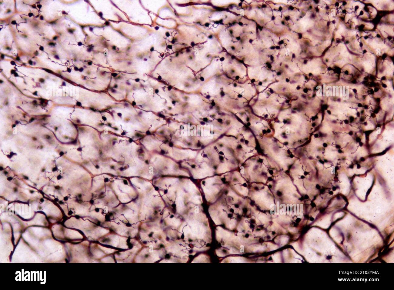 Light micrograph of a cerebellar granular layer stained with Golgi ...