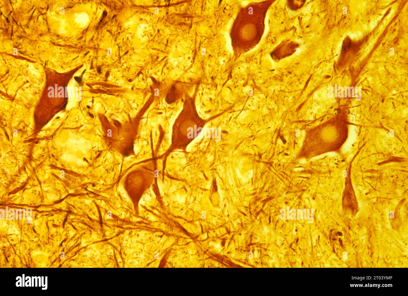 Light micrograph if multipolar neurons of the anterior horn of the ...