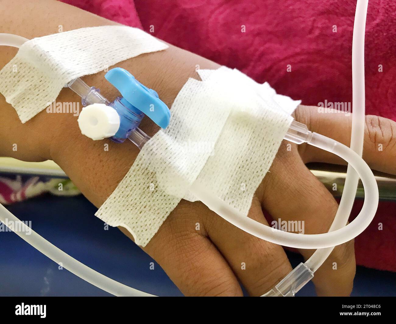 infusion device attached to the sick patient's arm Stock Photo - Alamy