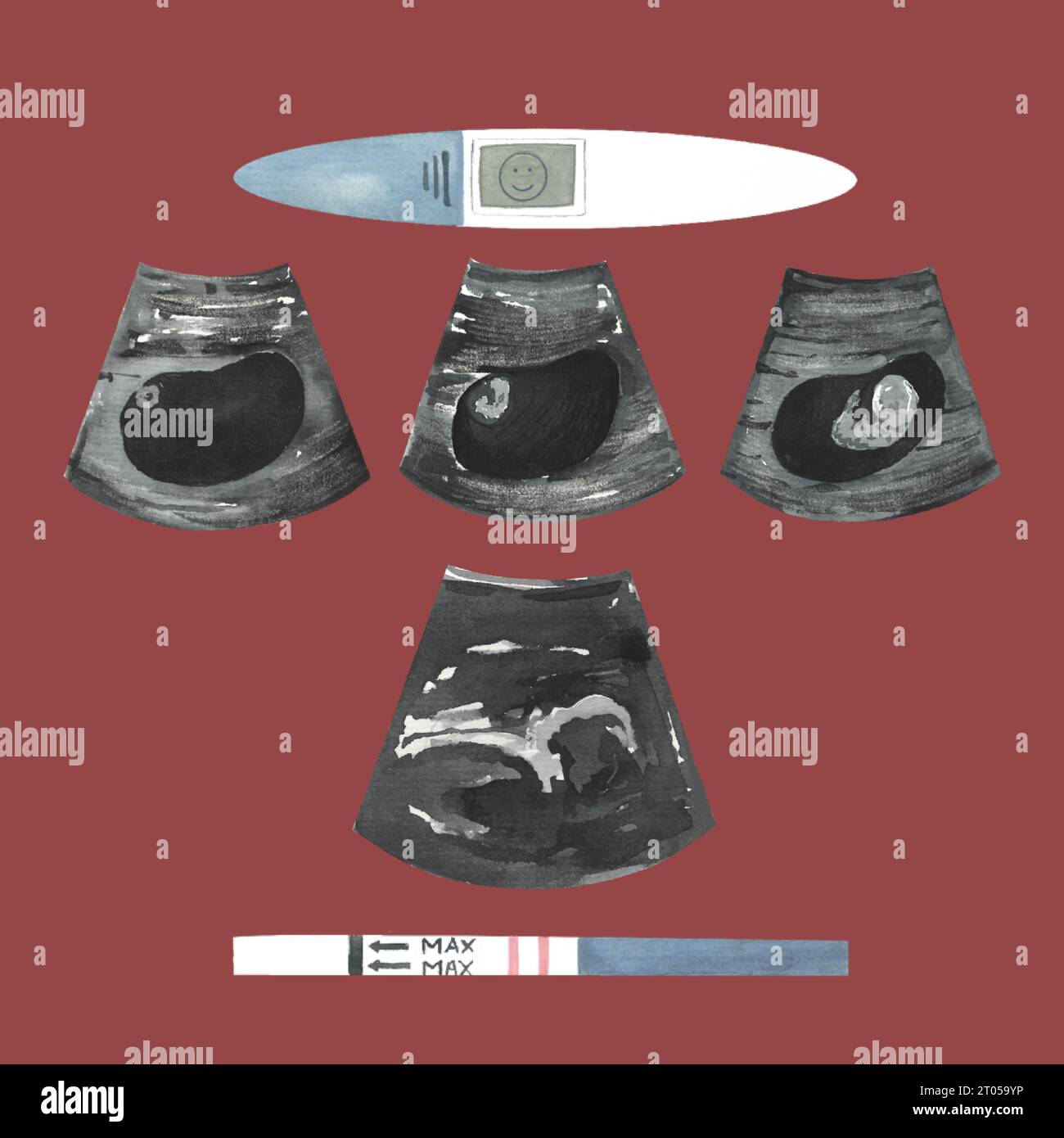 prenatal ultrasound, pregnancy study, positive test, gestational age ...