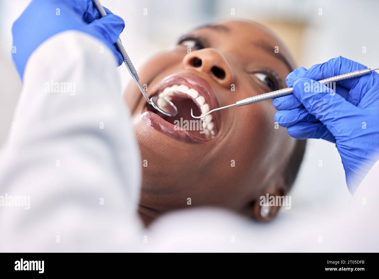 Dentist, patient and women in consultation, tools and check mouth for ...