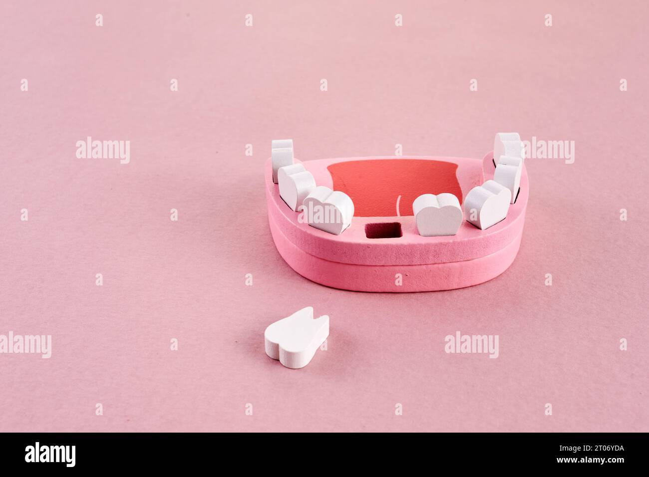 Teeth loss concept. Wooden jaw model with missing or extracted tooth ...