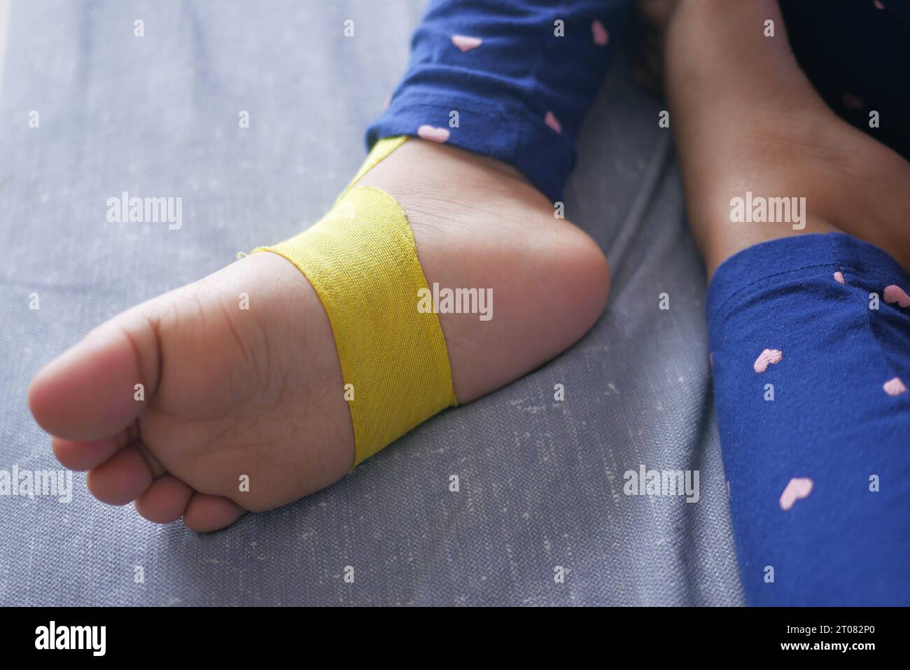 Elastic therapeutic blue tape applied to child leg. Kinesio Taping ...