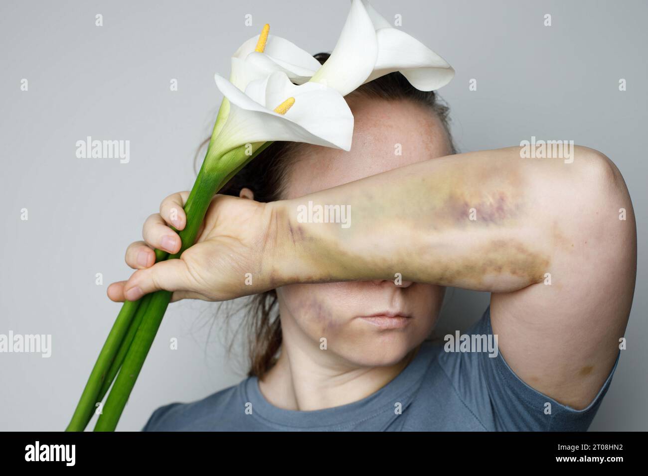 Woman hiding her face her hands with issues bruise and flowers ...