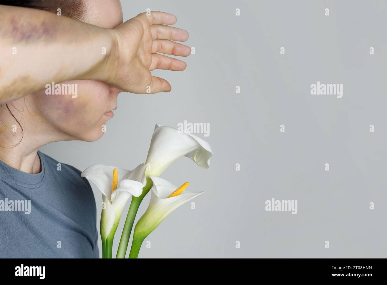 Stop abuse and domestic violence concept. Beautiful woman with issues ...