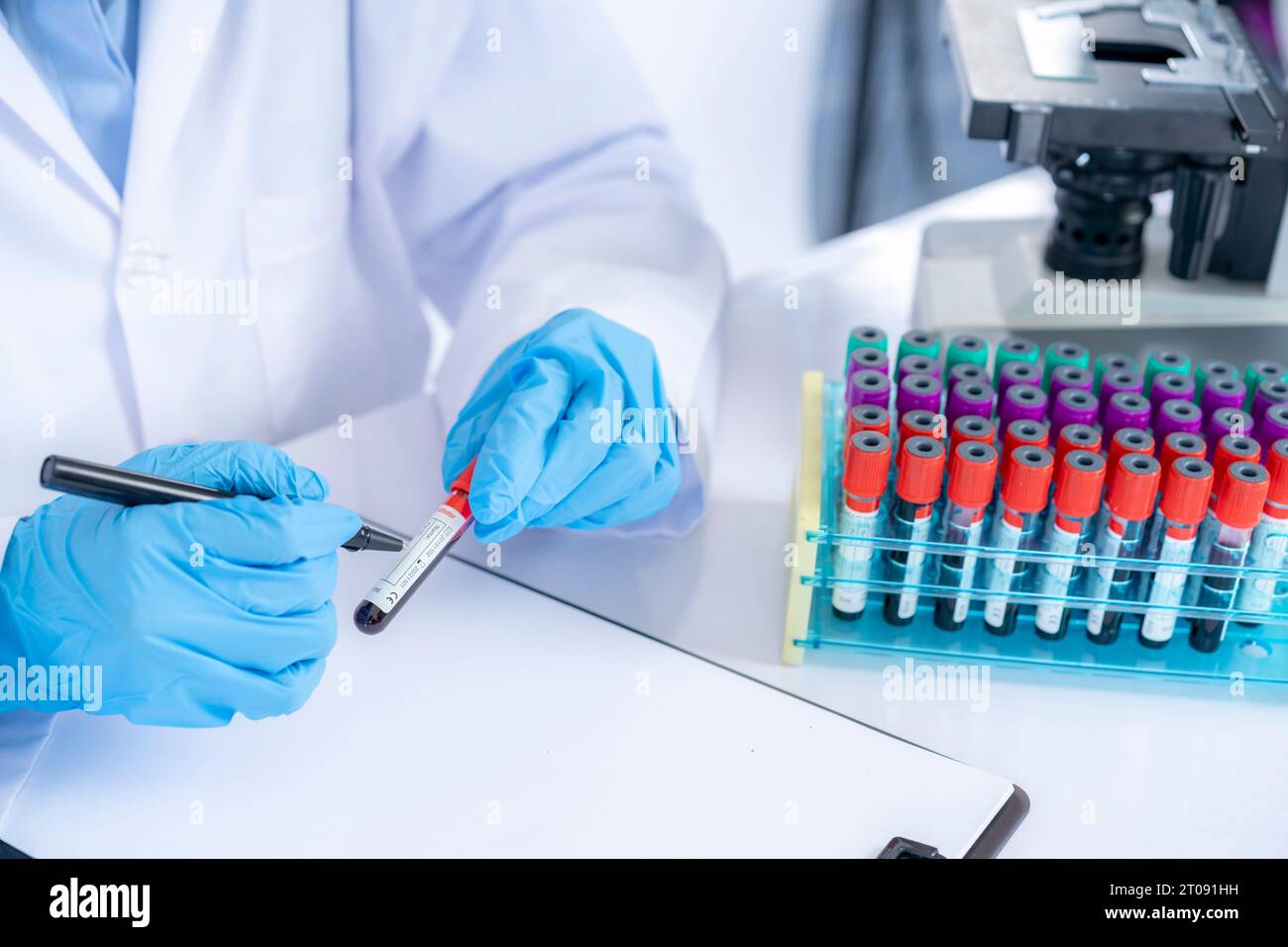 Close-up doctor hand write about a sample of blood in the tube Stock ...