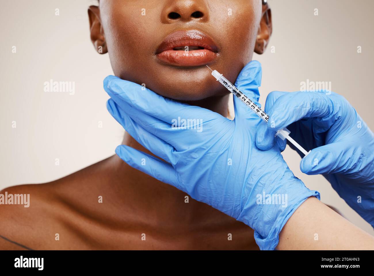 Closeup, black woman and needle with plastic surgery, healthcare and ...