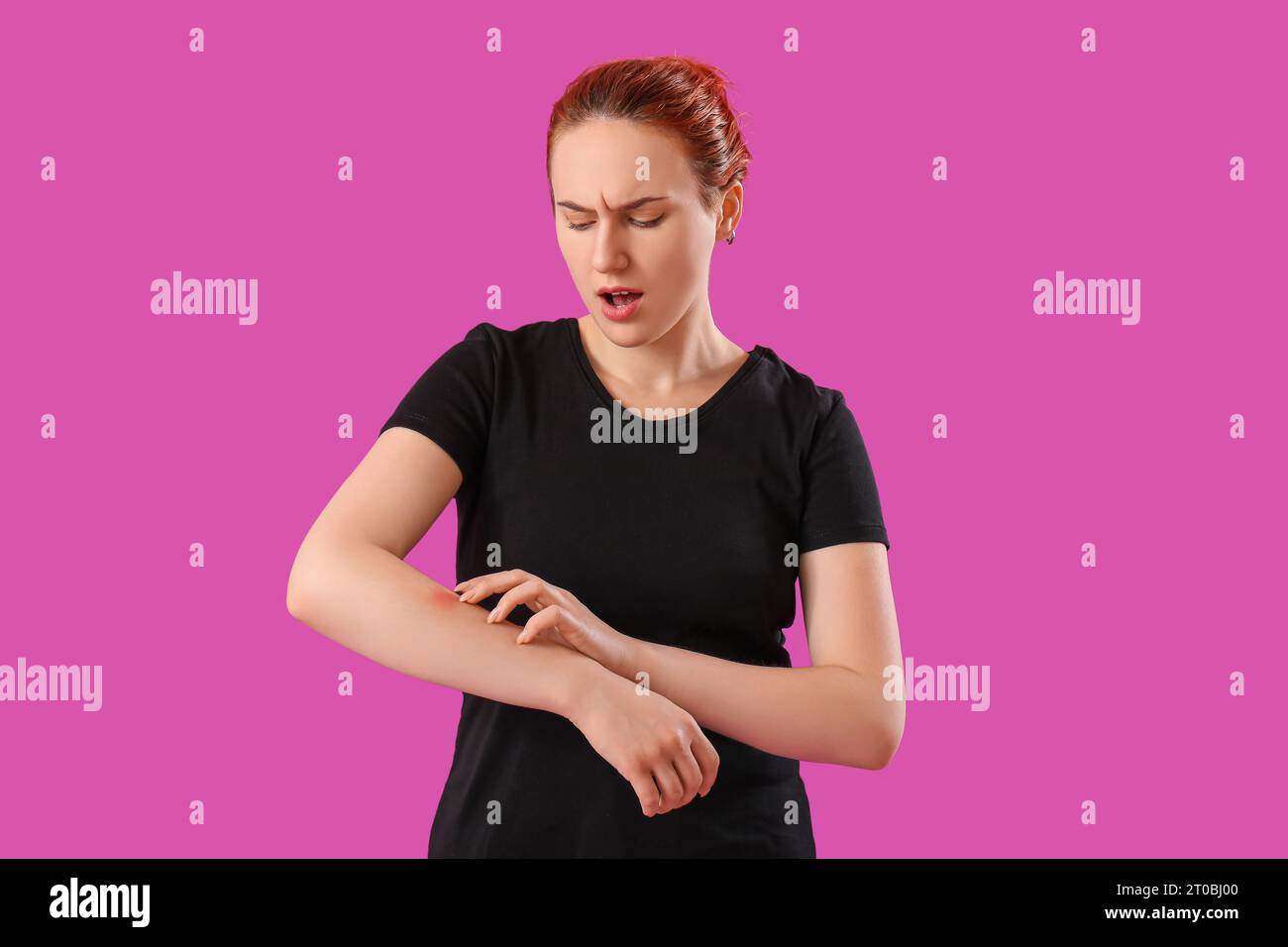 Young woman with mosquito bite on purple background Stock Photo - Alamy