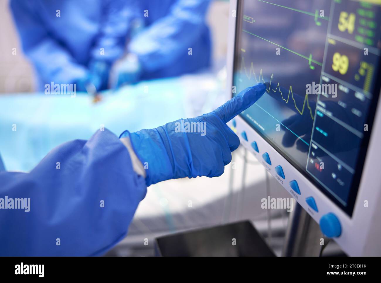 Nurse, monitor and electrocardiogram in surgery, cardiology and check ...