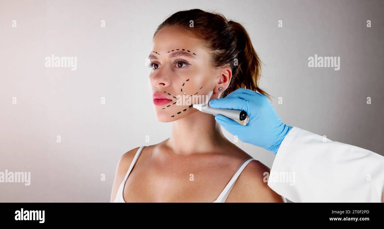 Facial Aesthetics Facelift. Plastic Surgery Drawings On Face Stock ...