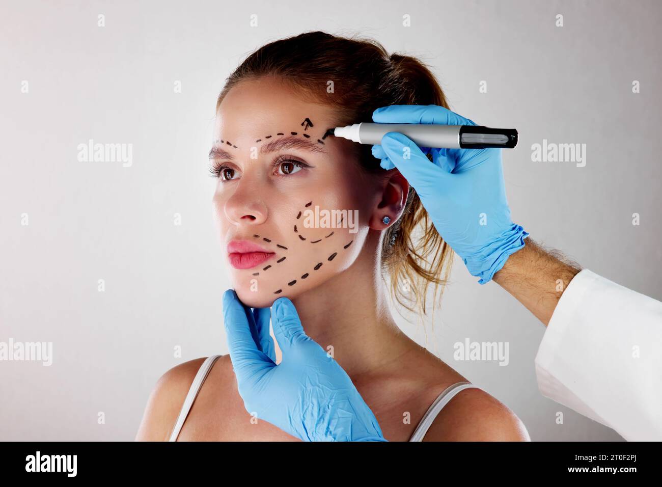 Facial Aesthetics Facelift. Plastic Surgery Drawings On Face Stock ...