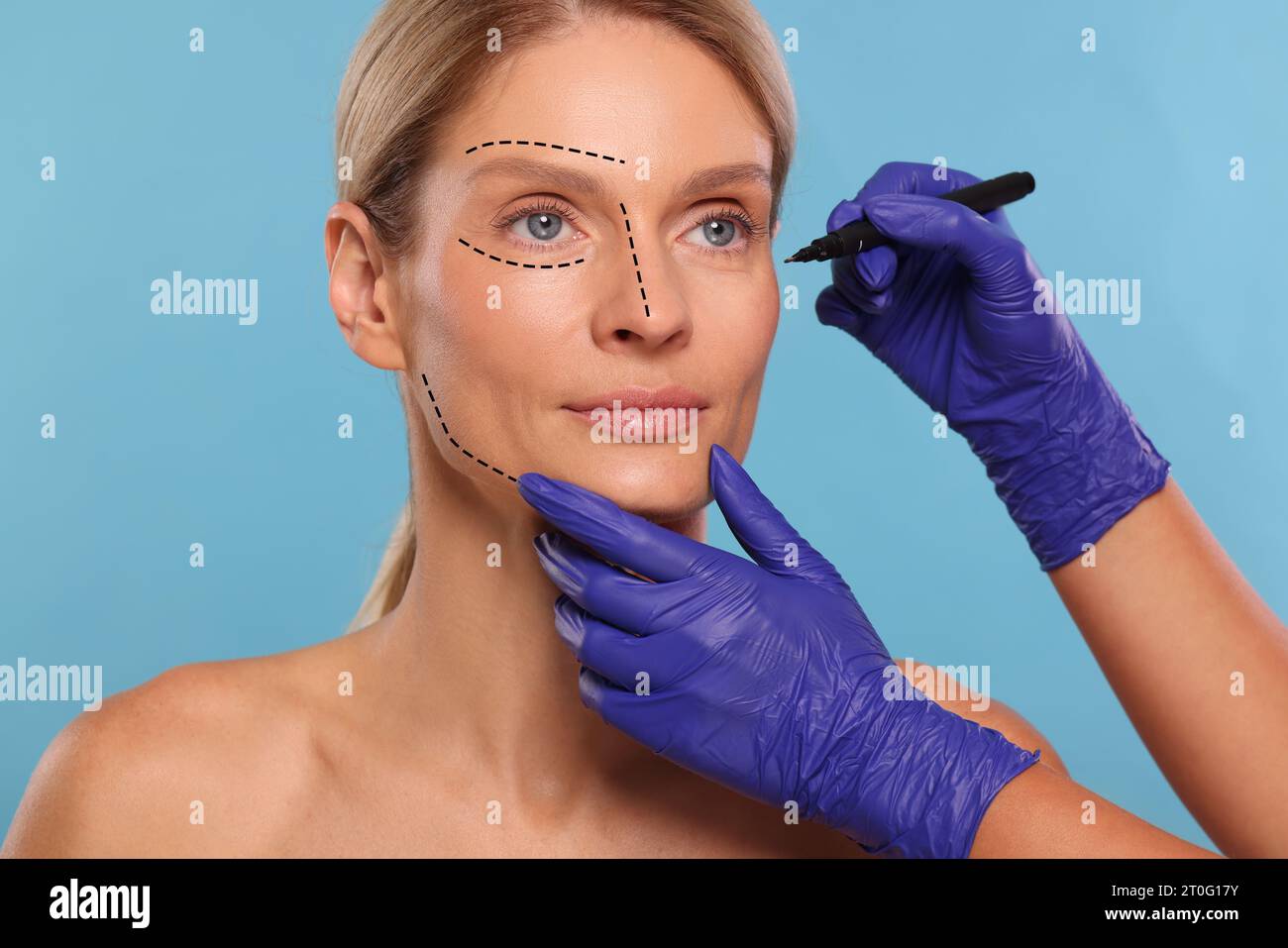 Woman preparing for cosmetic surgery, light blue background. Doctor ...