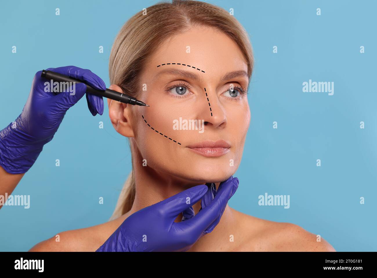 Woman preparing for cosmetic surgery, light blue background. Doctor ...