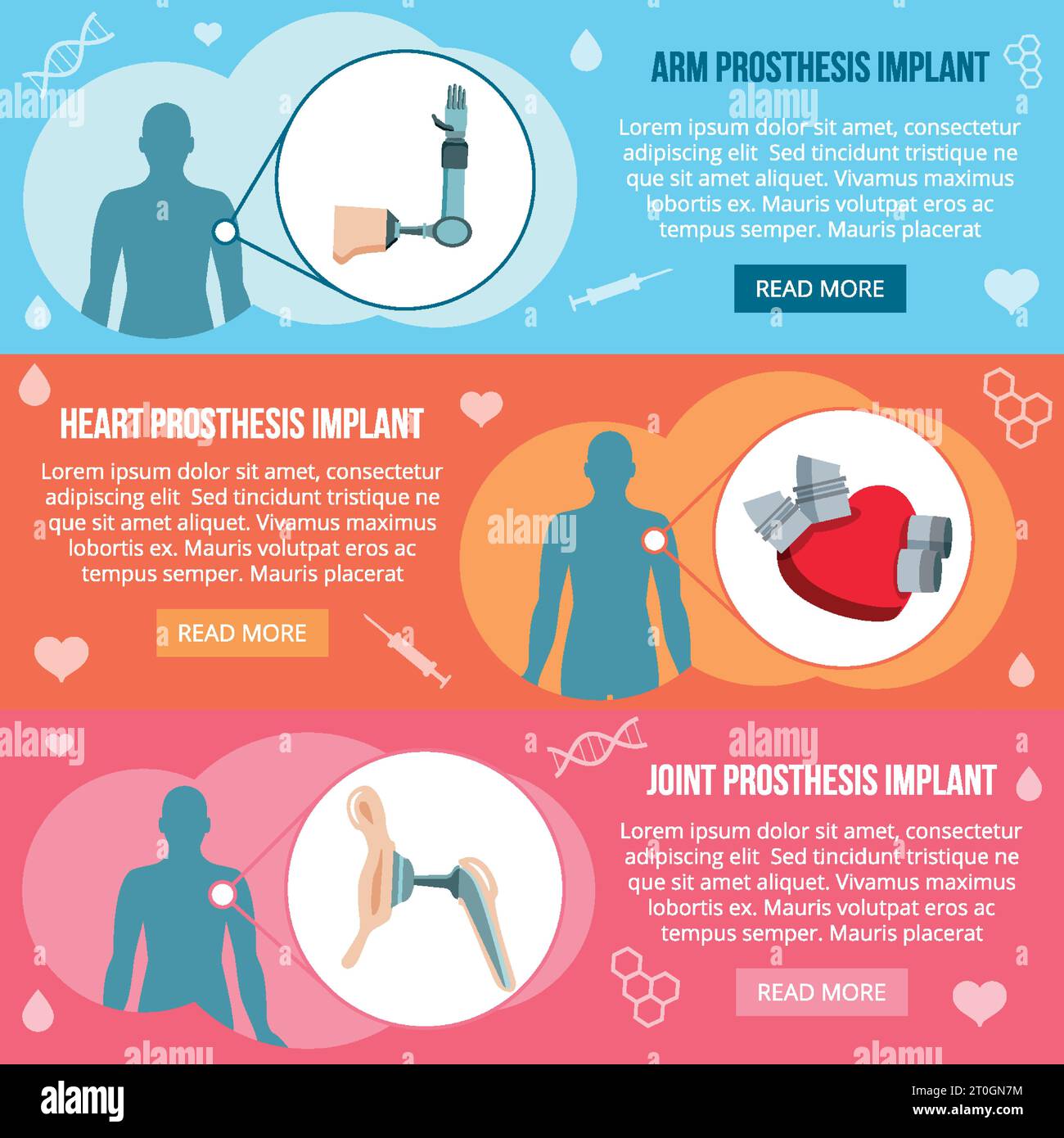 Medical prothesis implants technology 3 flat horizontal colorful ...