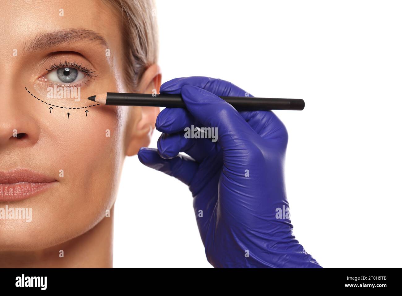 Woman preparing for cosmetic surgery, white background. Doctor drawing ...