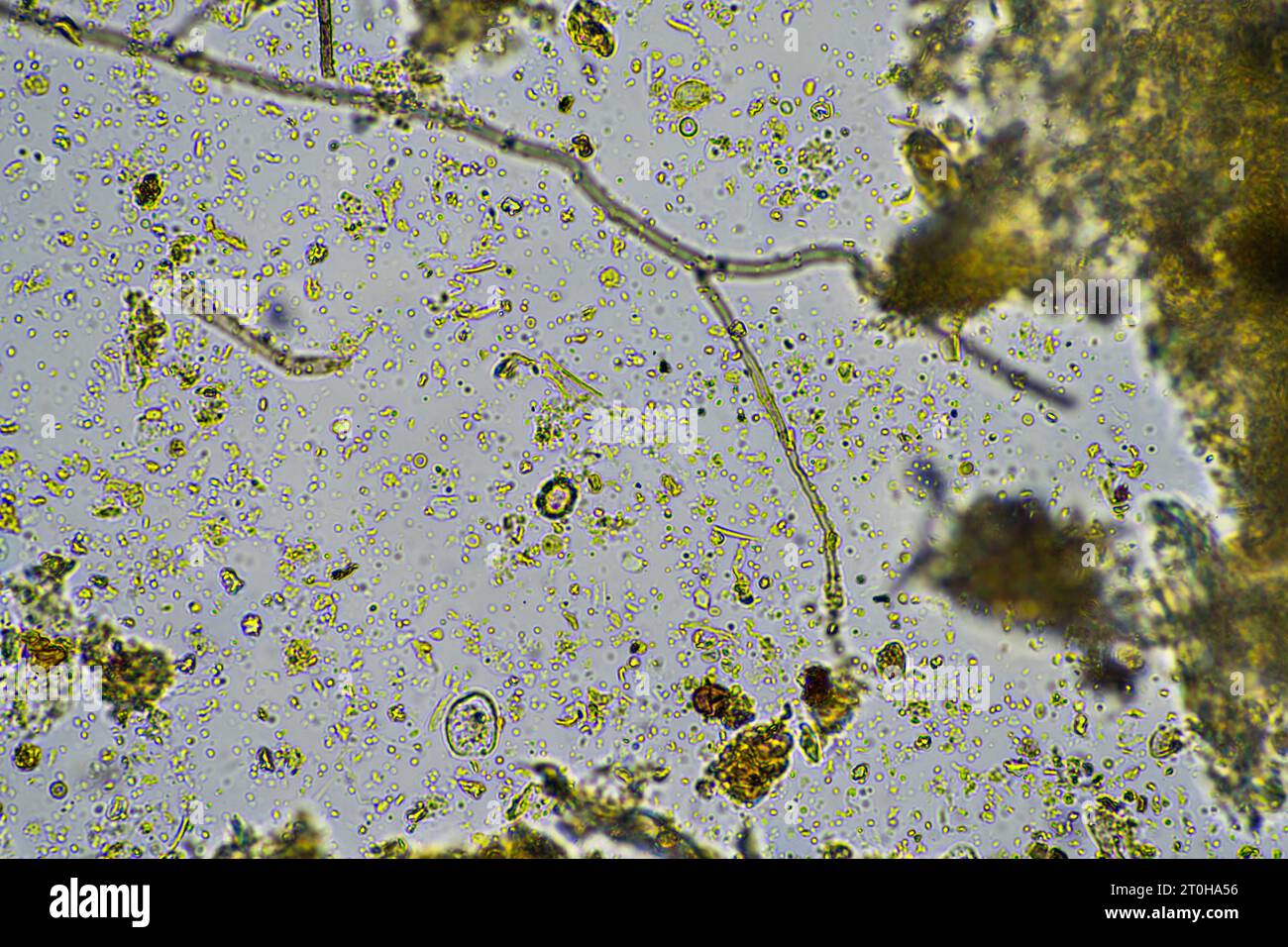 Microorganisms and biology in Compost and soil sample under the ...