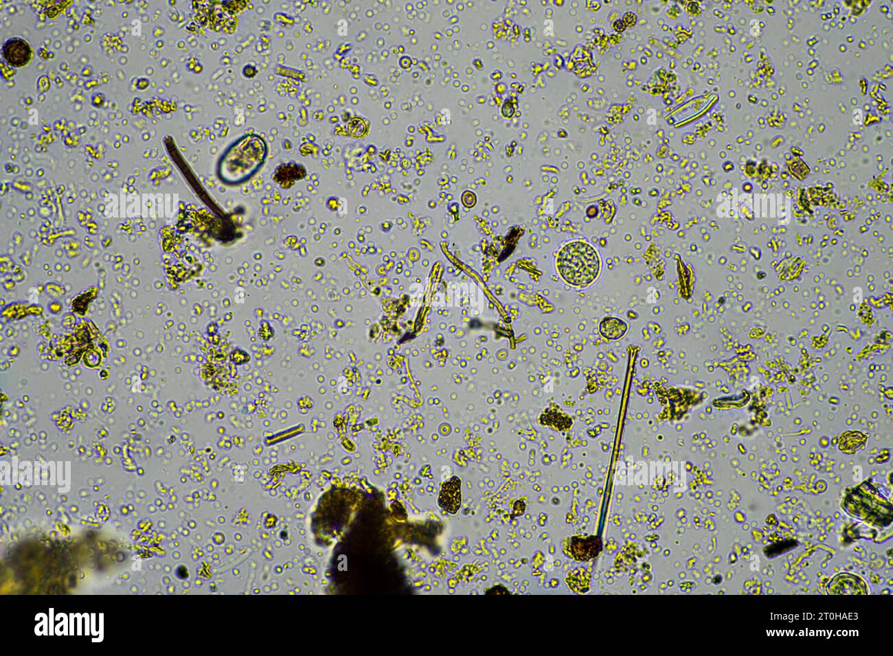 Microorganisms and biology in Compost and soil sample under the ...