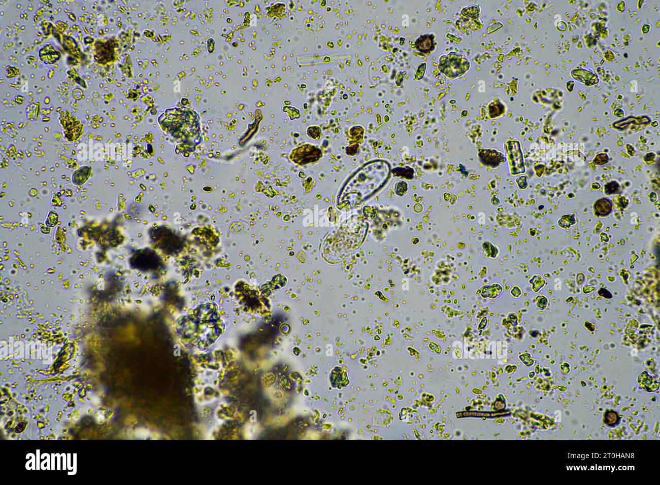 Microorganisms and biology in Compost and soil sample under the ...