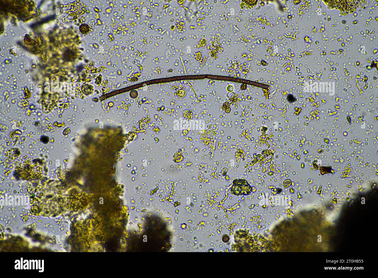 Microorganisms and biology in Compost and soil sample under the ...