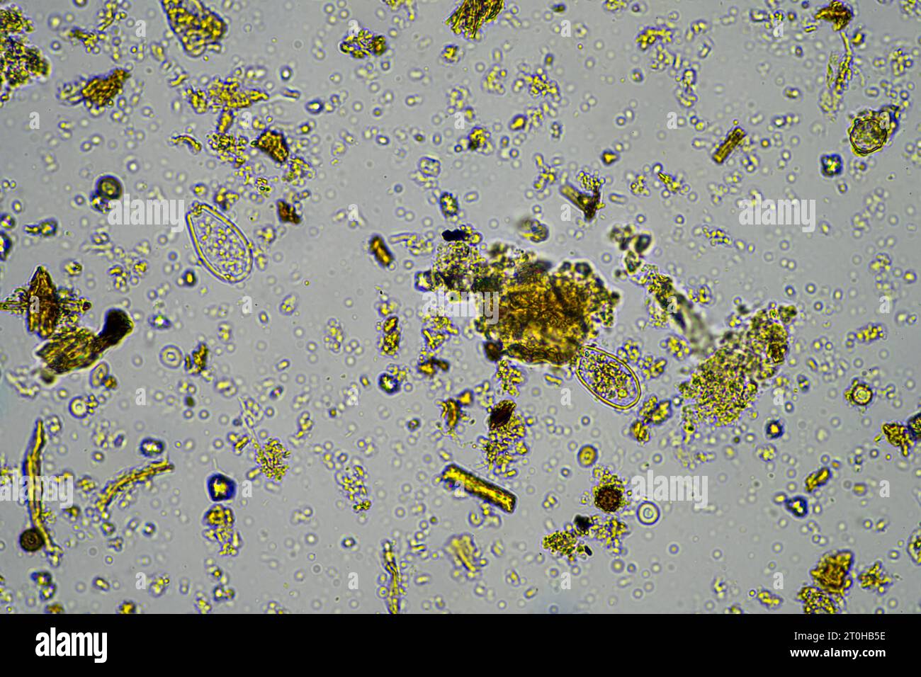 Microorganisms and biology in Compost and soil sample under the ...