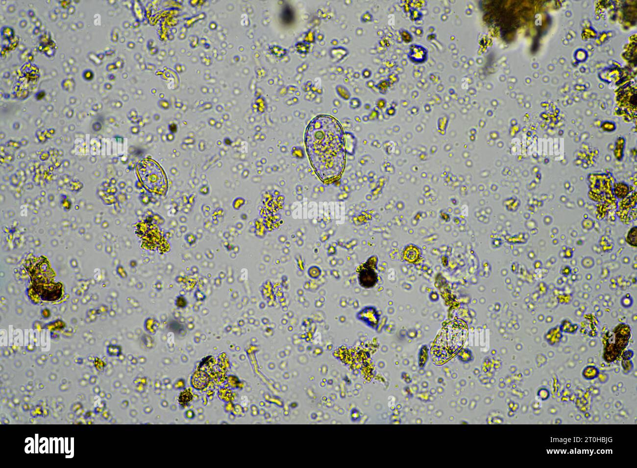 Microorganisms and biology in Compost and soil sample under the ...