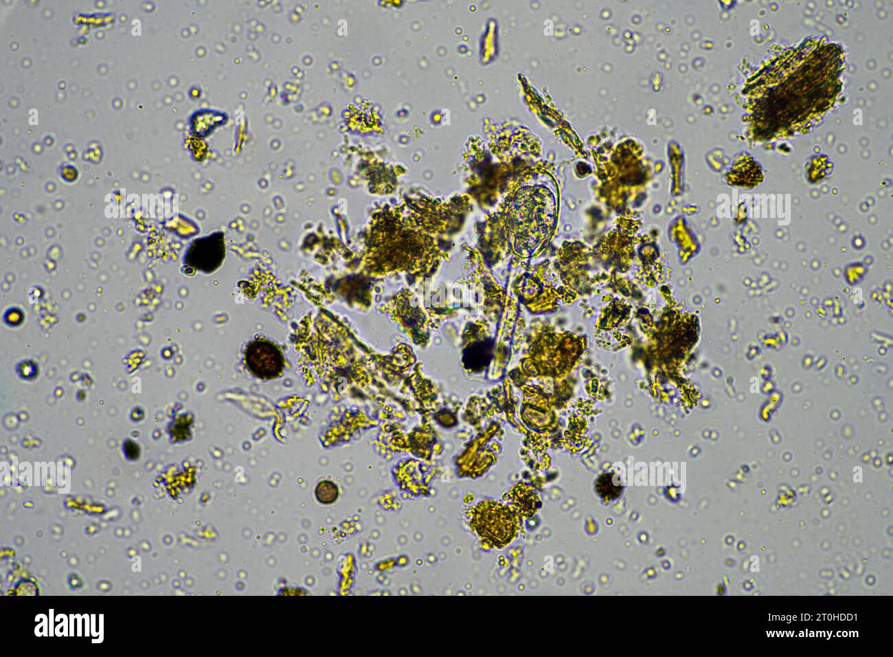 Microorganisms and biology in Compost and soil sample under the ...