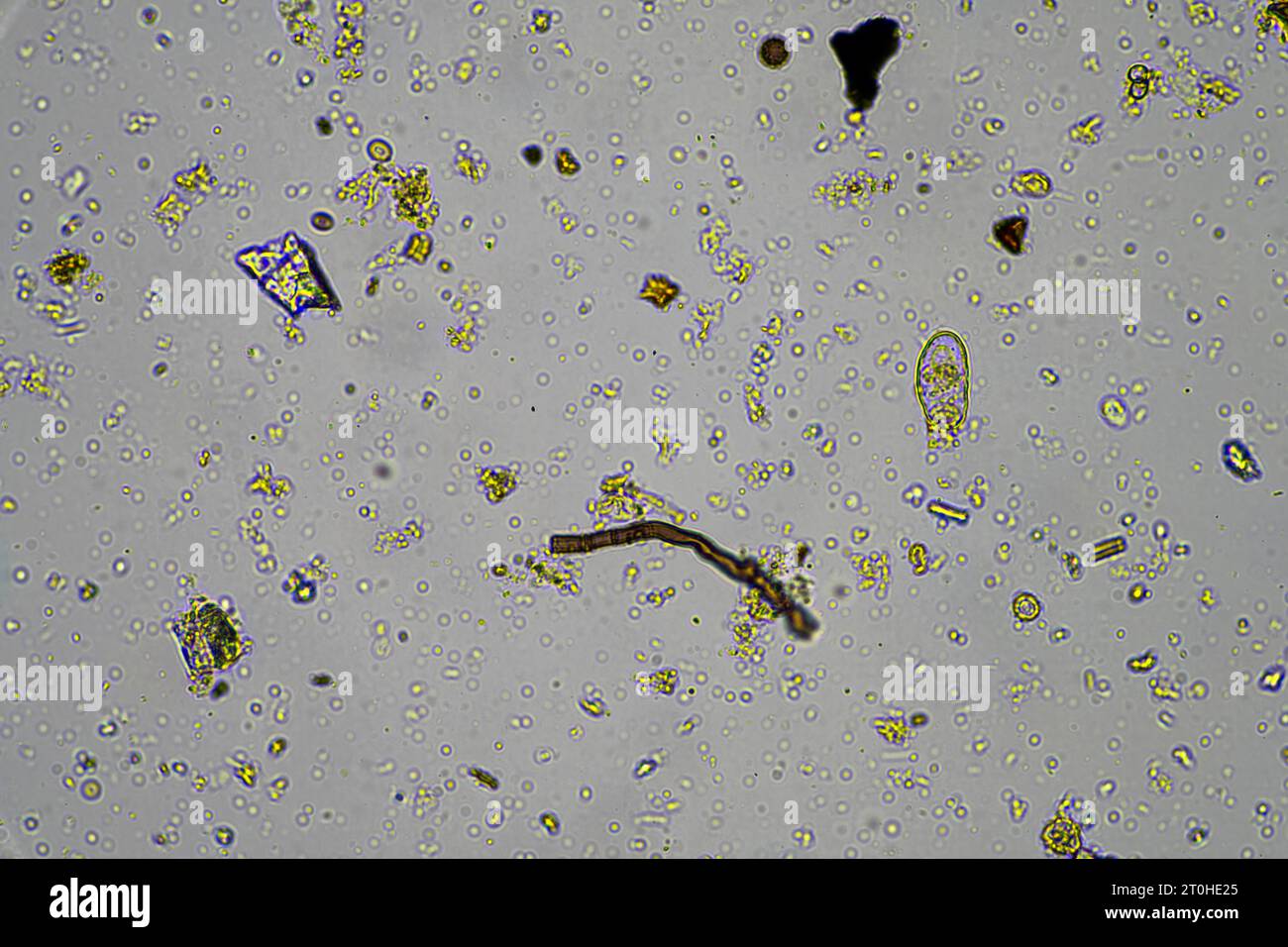 Microorganisms and biology in Compost and soil sample under the ...