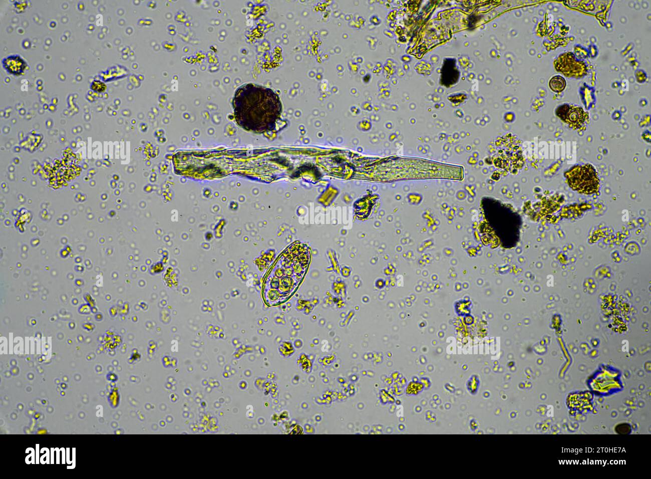 Microorganisms and biology in Compost and soil sample under the ...