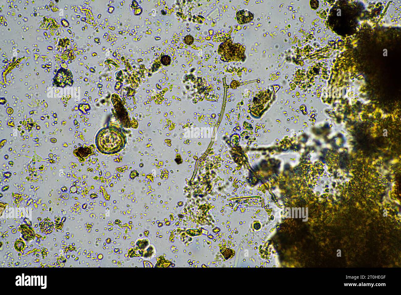 Microorganisms and biology in Compost and soil sample under the ...