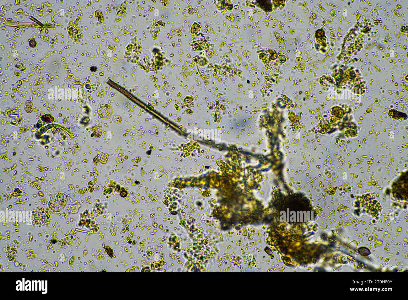 Microorganisms and biology in Compost and soil sample under the ...