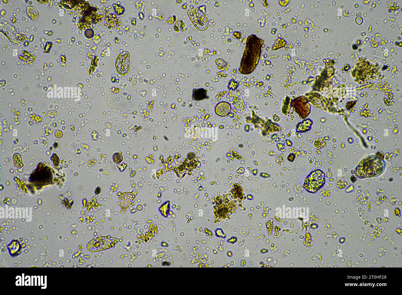 Microorganisms and biology in Compost and soil sample under the ...