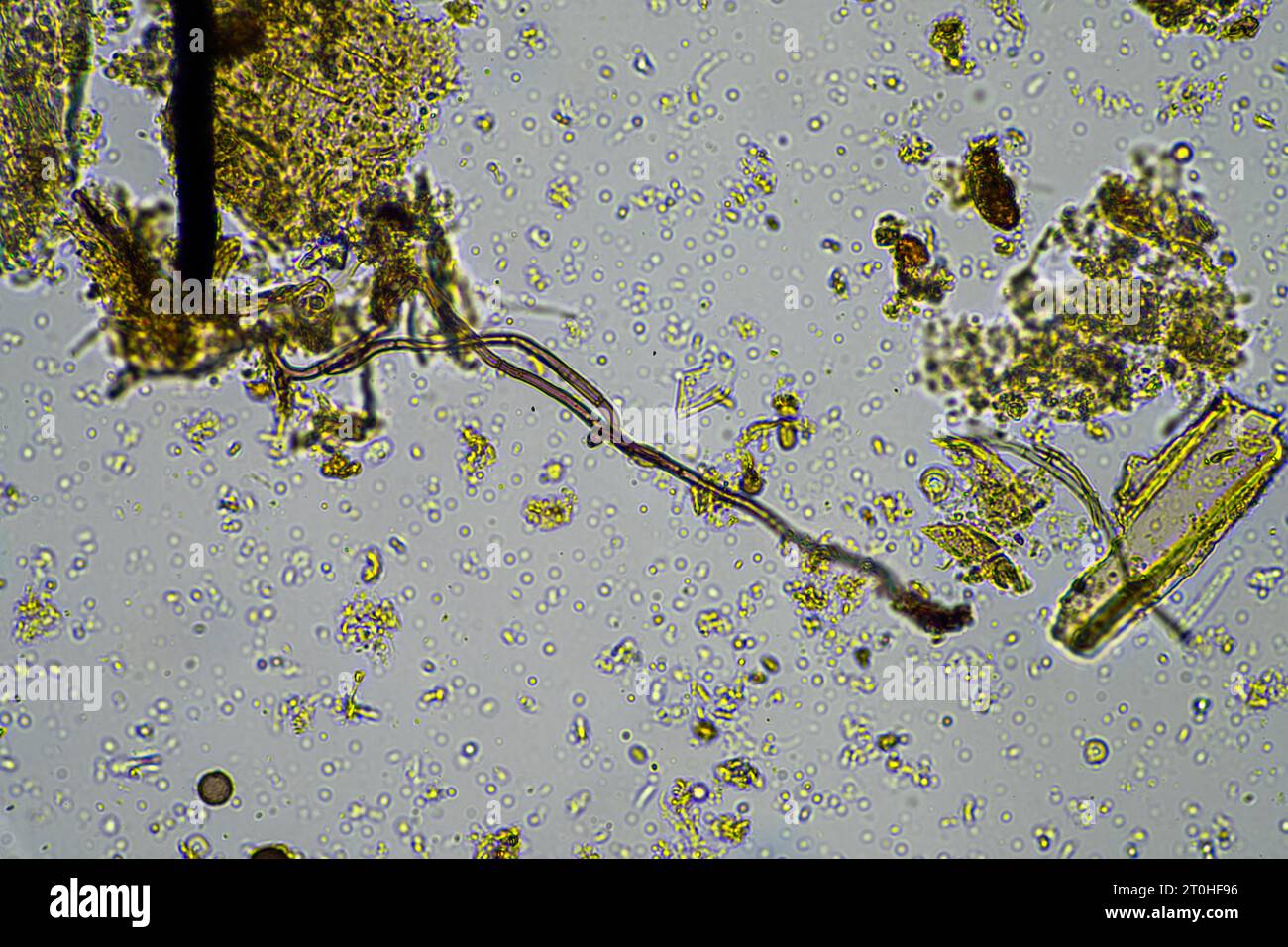Microorganisms and biology in Compost and soil sample under the ...