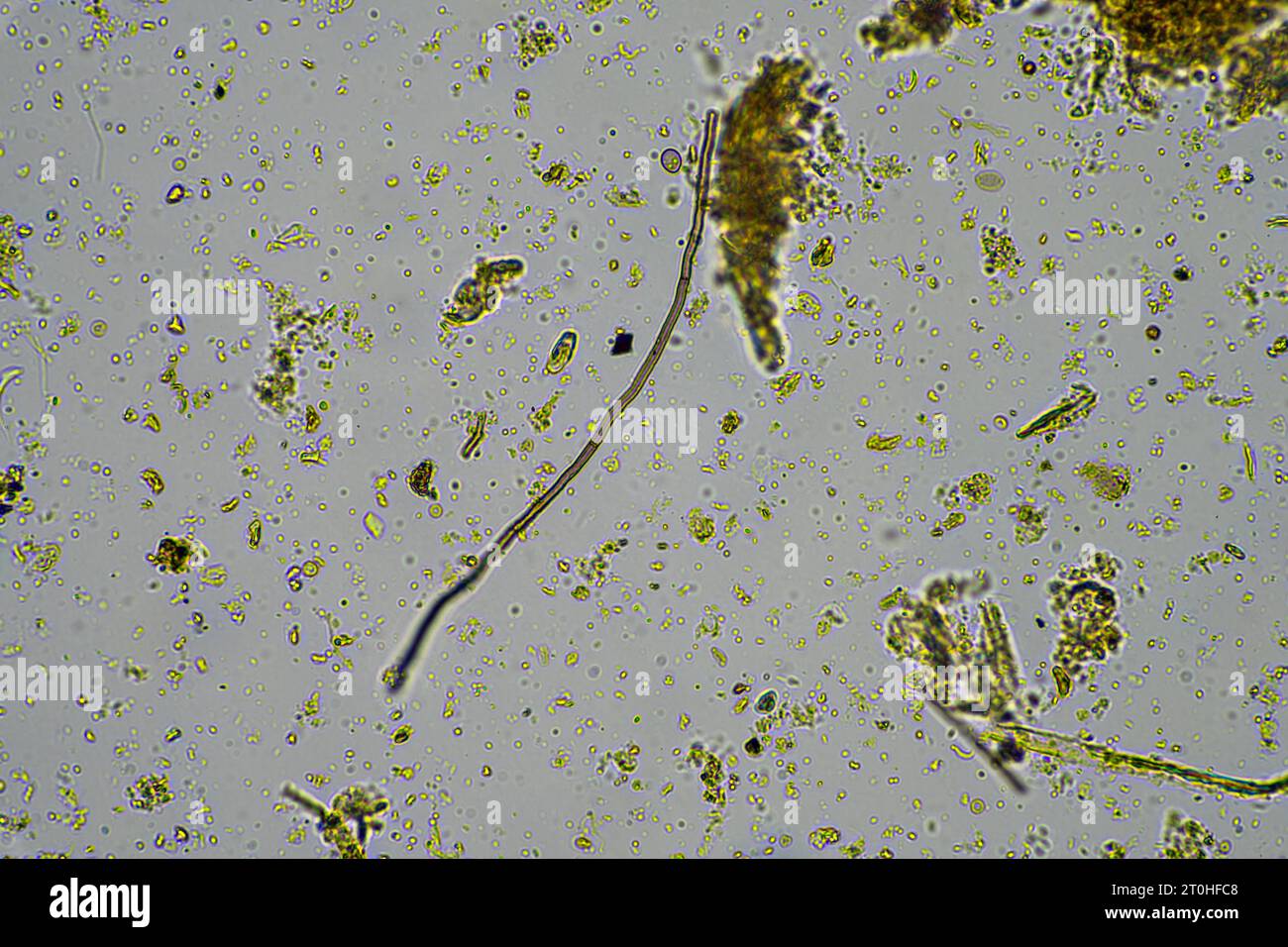 Microorganisms and biology in Compost and soil sample under the ...