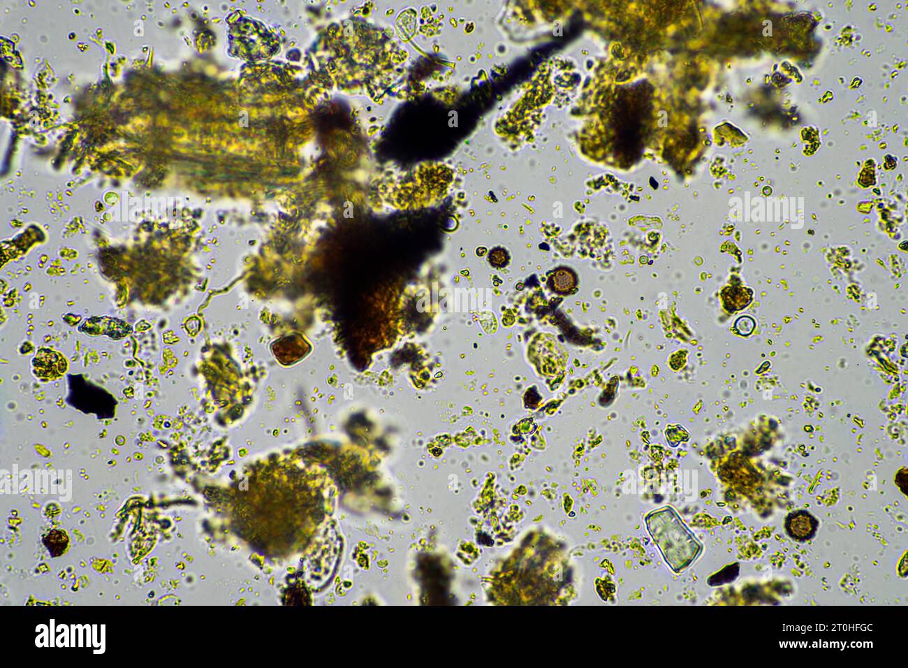 Microorganisms and biology in Compost and soil sample under the ...