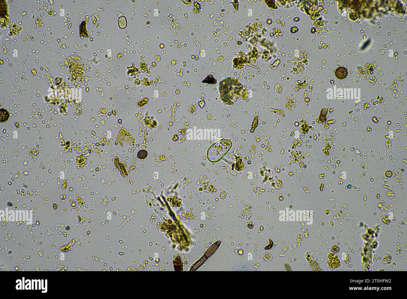 Microorganisms and biology in Compost and soil sample under the ...