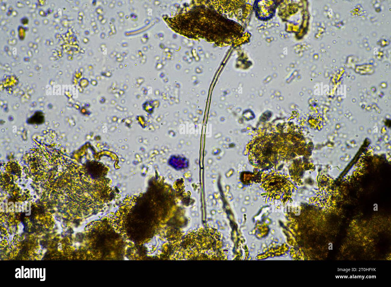 Microorganisms and biology in Compost and soil sample under the ...